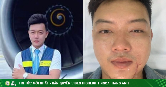 Nhân viên hàng không có phát ngôn "gây bão" MXH, hóa ra là cựu thành ...