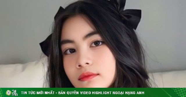 Chỉ vì "dậy thì quá thành công" mà em gái Lọ Lem bị nghi ngờ "đụng dao kéo"