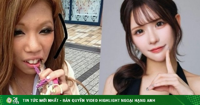 Cô gái Nhật chi 170.000 USD để từ 'cú hóa công'